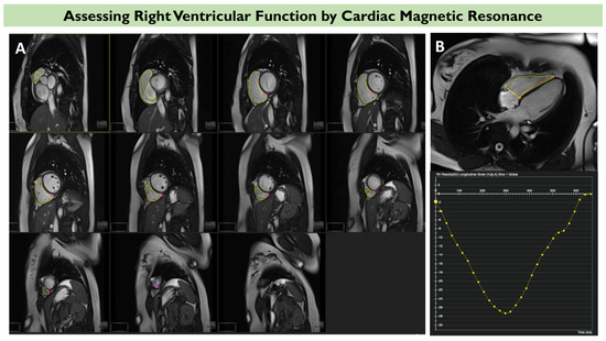 Diagnostics | Free Full-Text | Unmet Needs in the Assessment of Right ...