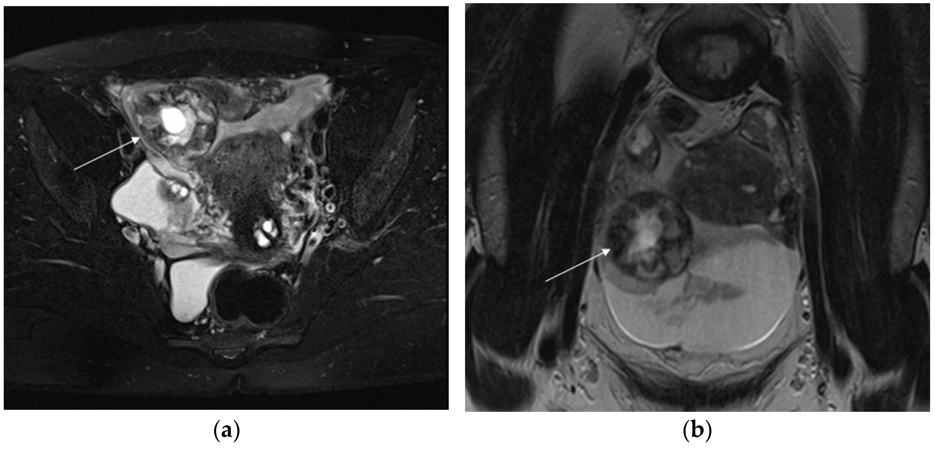 Diagnostics | Free Full-Text | Imaging of Acute Abdominopelvic Pain in ...