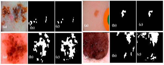 Diagnostics | Free Full-Text | Dermo-Seg: ResNet-UNet Architecture and ...