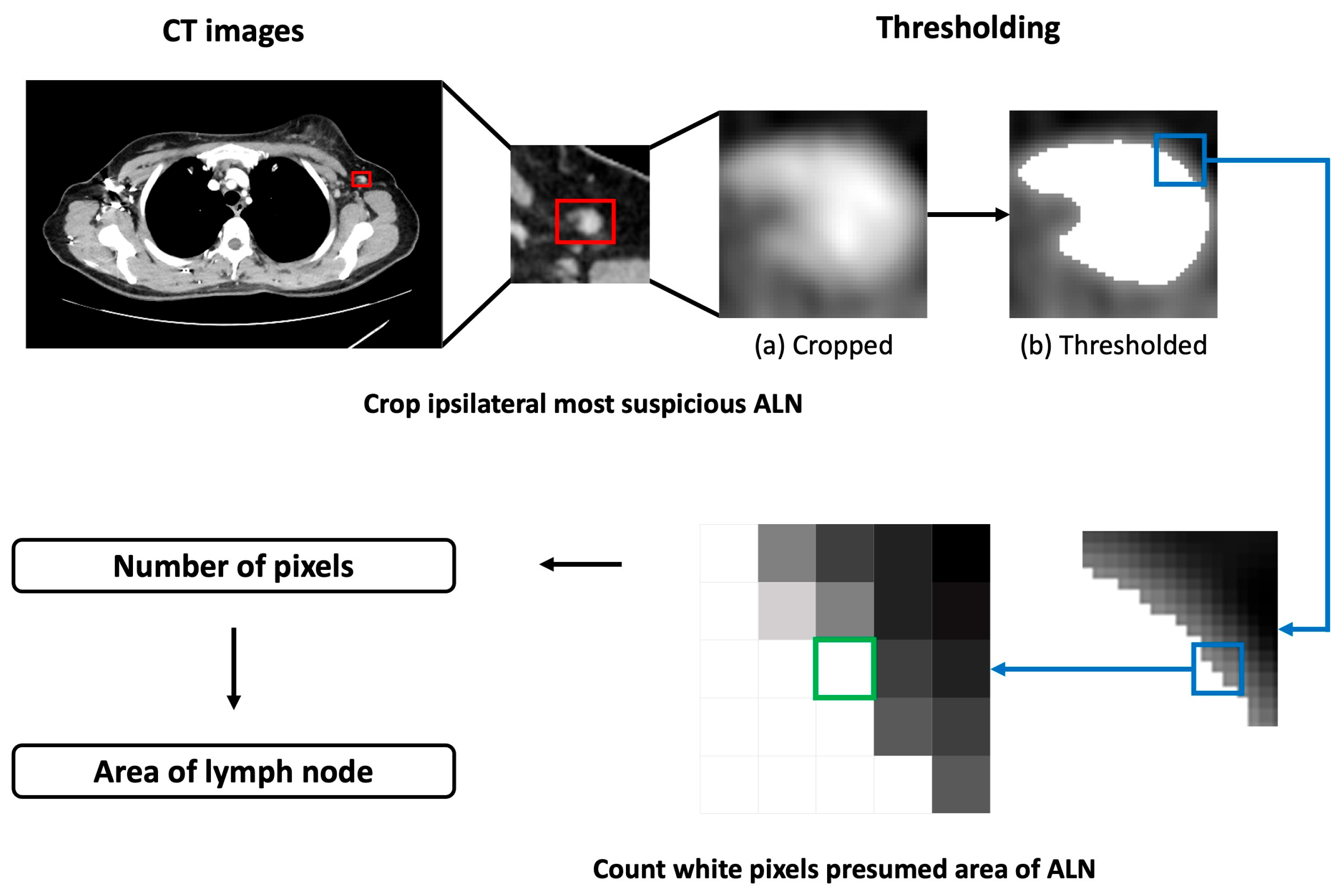 Application of Machine Learning Algorithm in Predicting Axillary Lymph Node Metastasis from ...