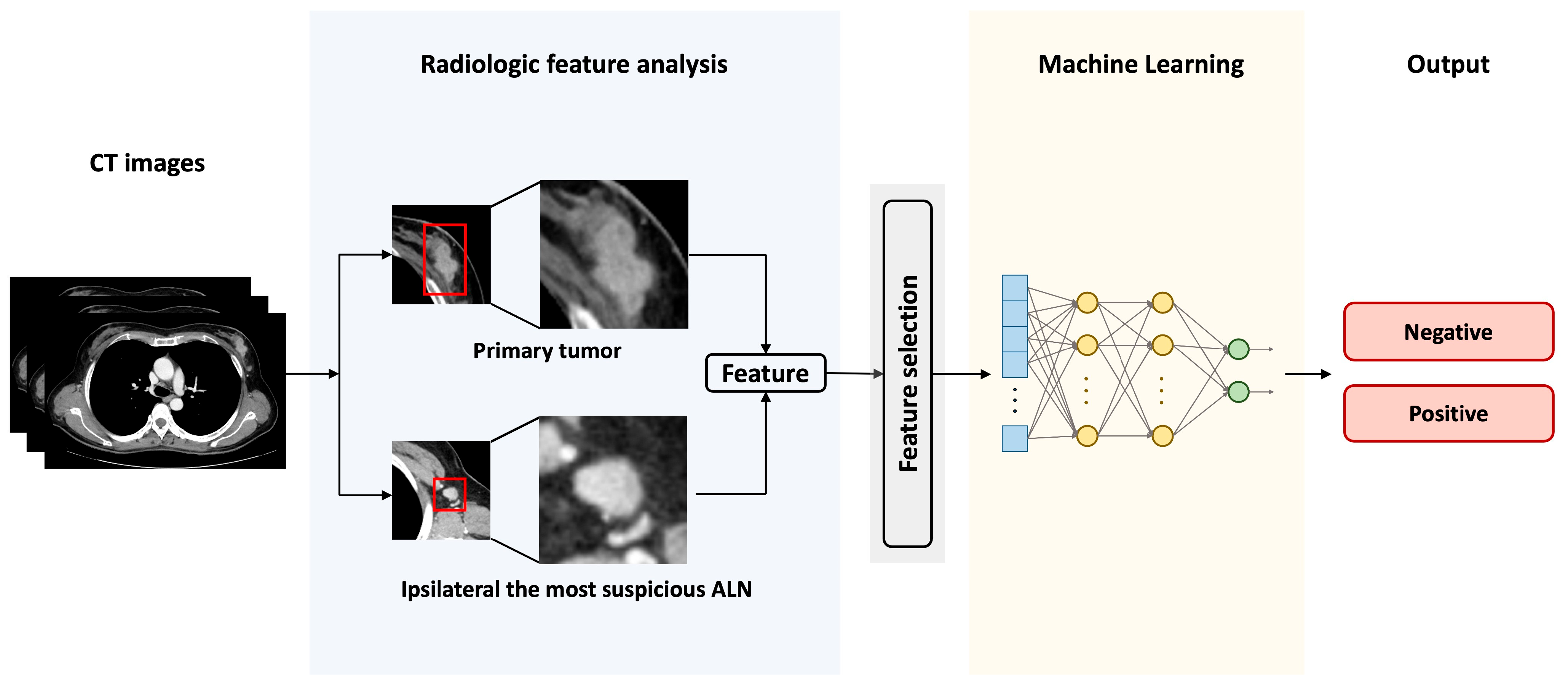 Application of Machine Learning Algorithm in Predicting Axillary Lymph Node Metastasis from ...