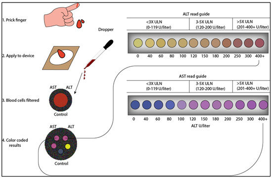 Low-Cost Point-of-Care Monitoring of ALT and AST Is Promising for ...