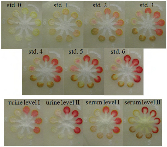 Low-Cost Point-of-Care Monitoring of ALT and AST Is Promising for ...