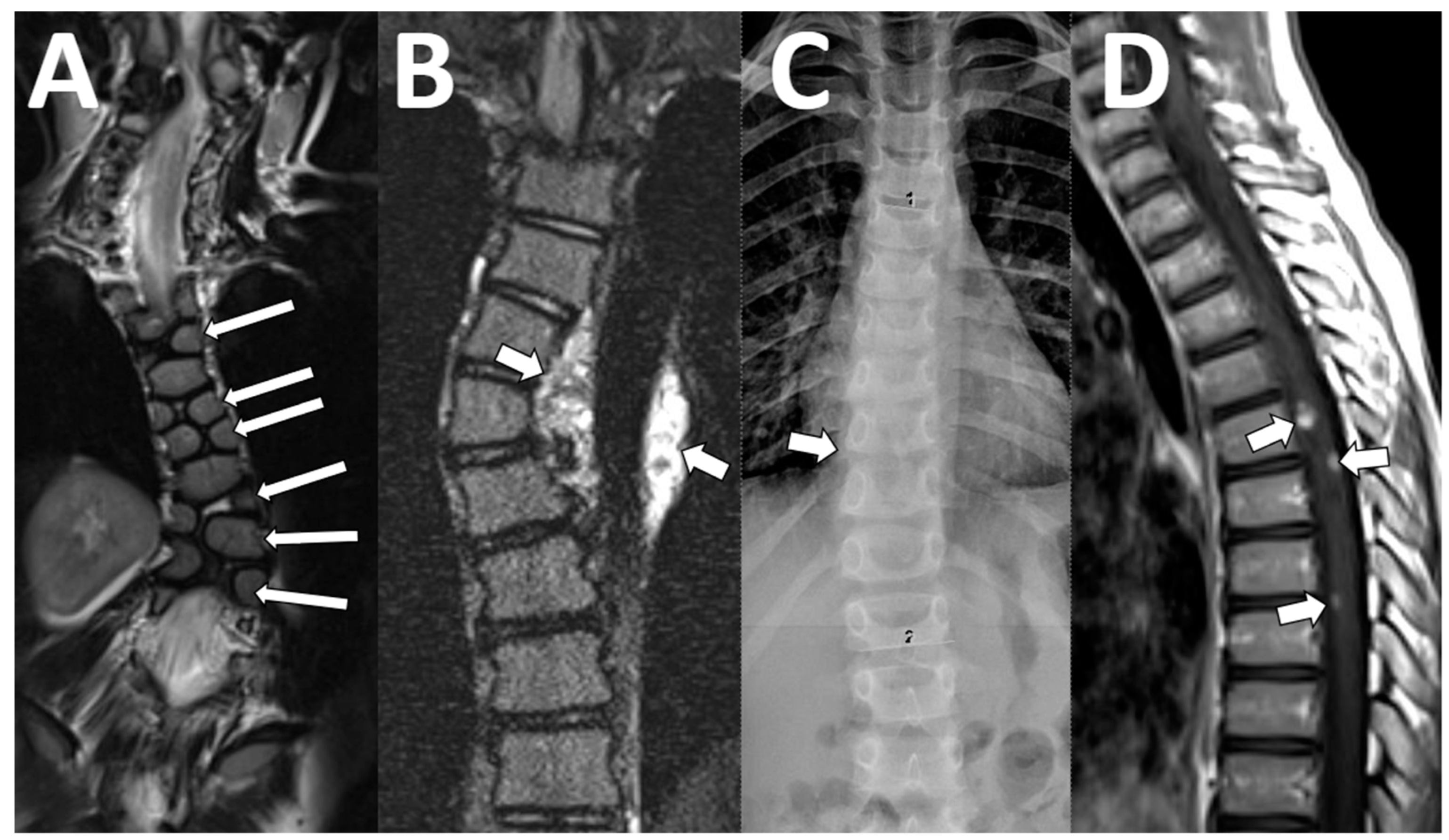 Diagnostic Excellence in Pediatric Spine Imaging: Using Contextualized ...