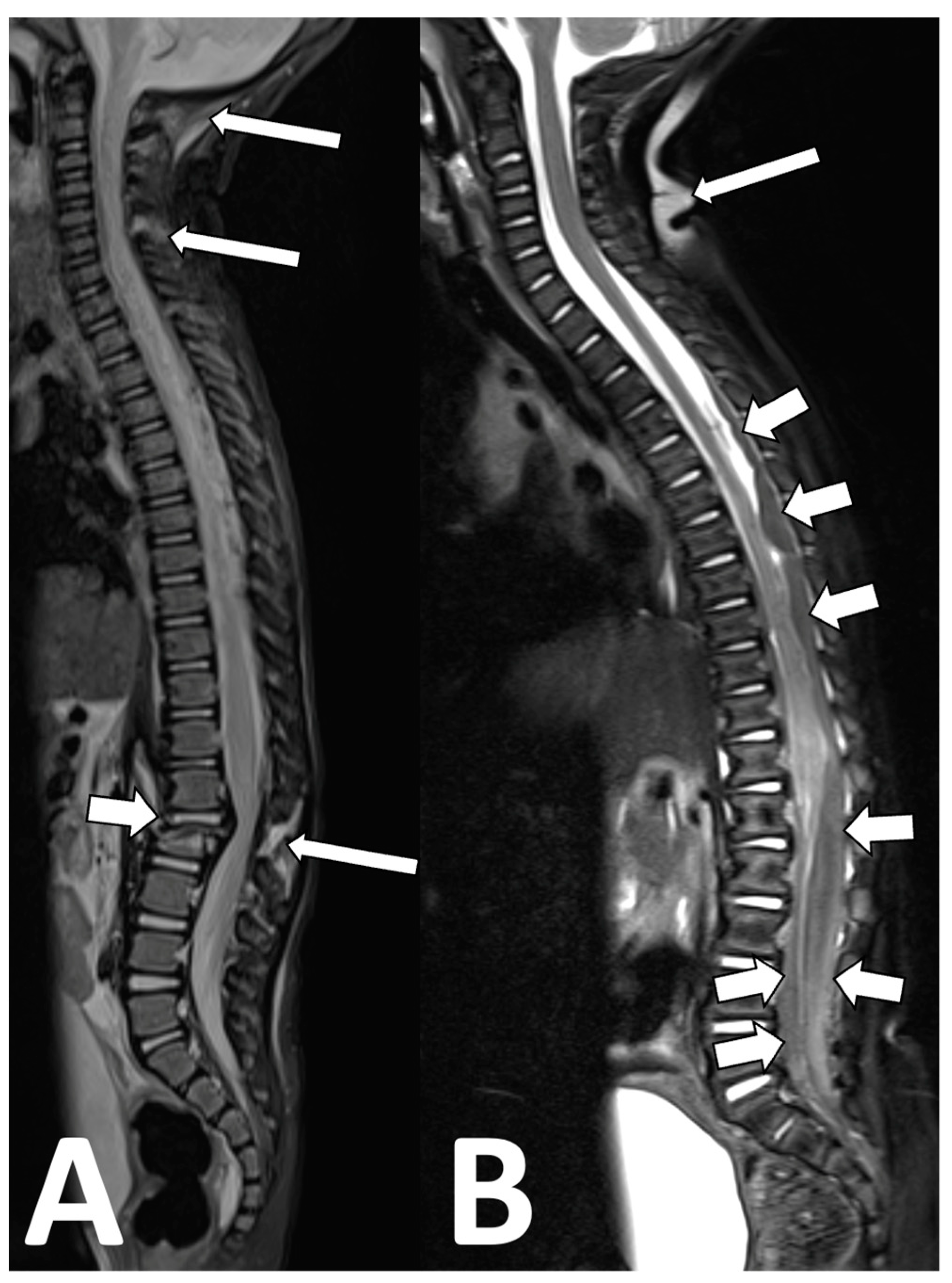 Diagnostic Excellence in Pediatric Spine Imaging: Using Contextualized ...