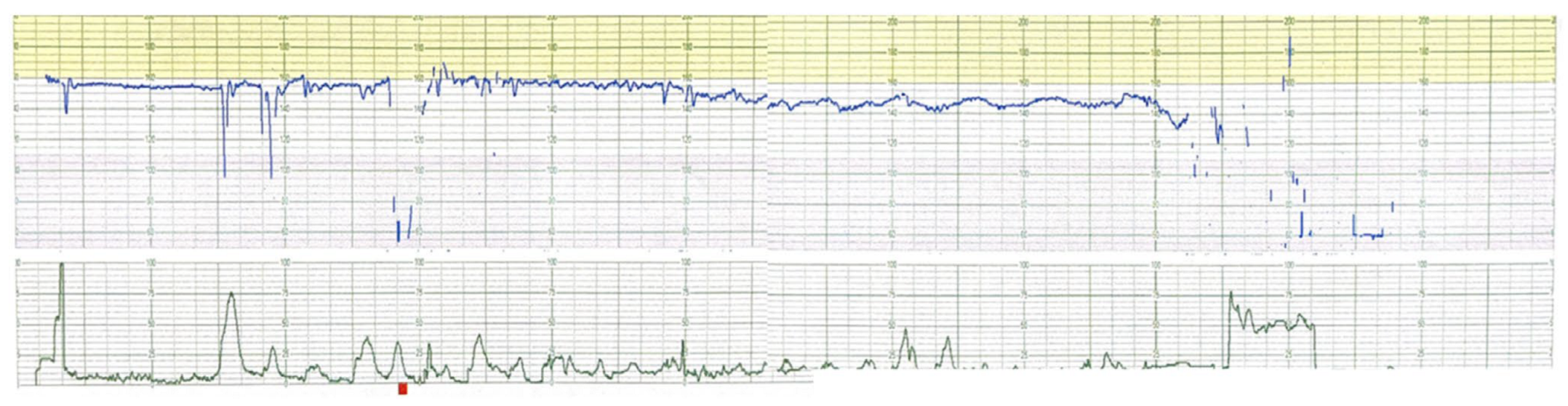 Diagnostics | Free Full-Text | Ultrasound Doppler Findings in Fetal ...