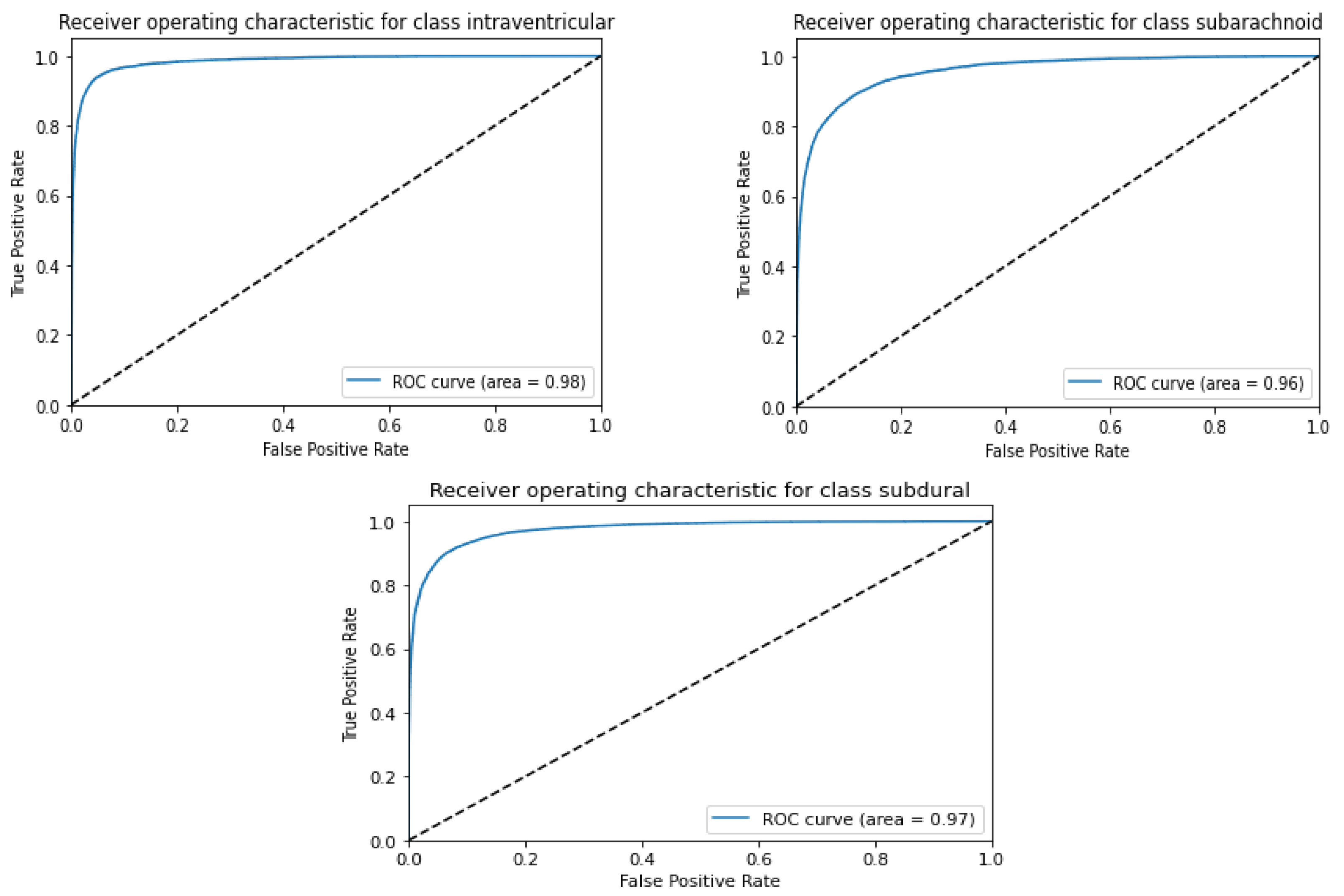 Automated Computer-Aided Detection and Classification of Intracranial ...
