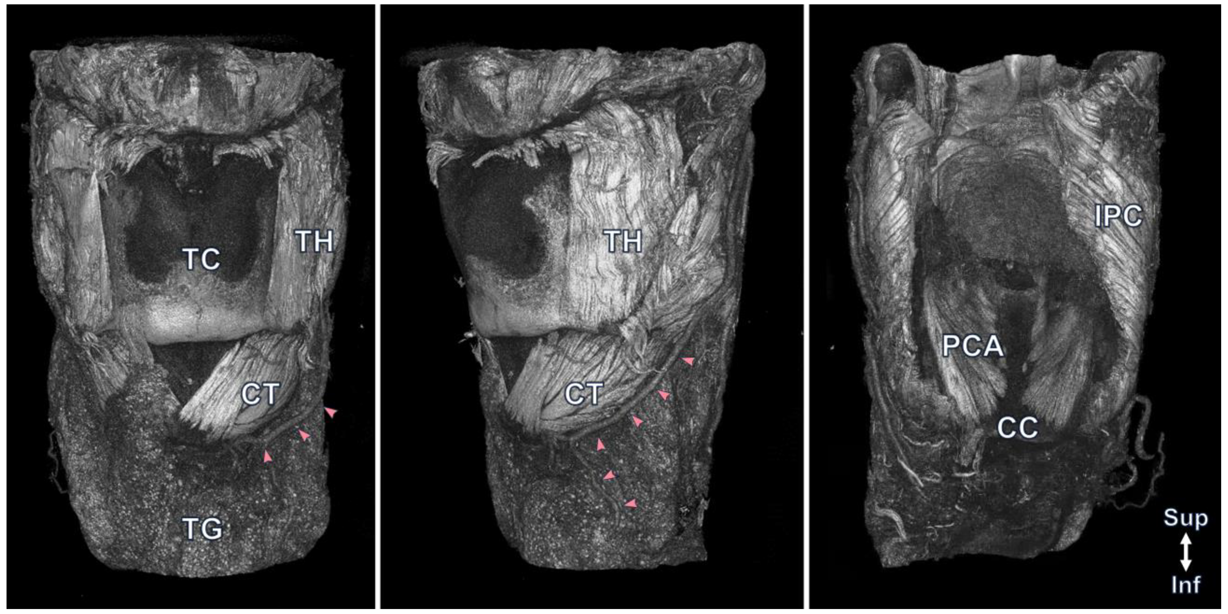 Observation of Anatomical Structures in the Human Larynx Using Micro Computed Tomography with Lugol s Solution Enhancement