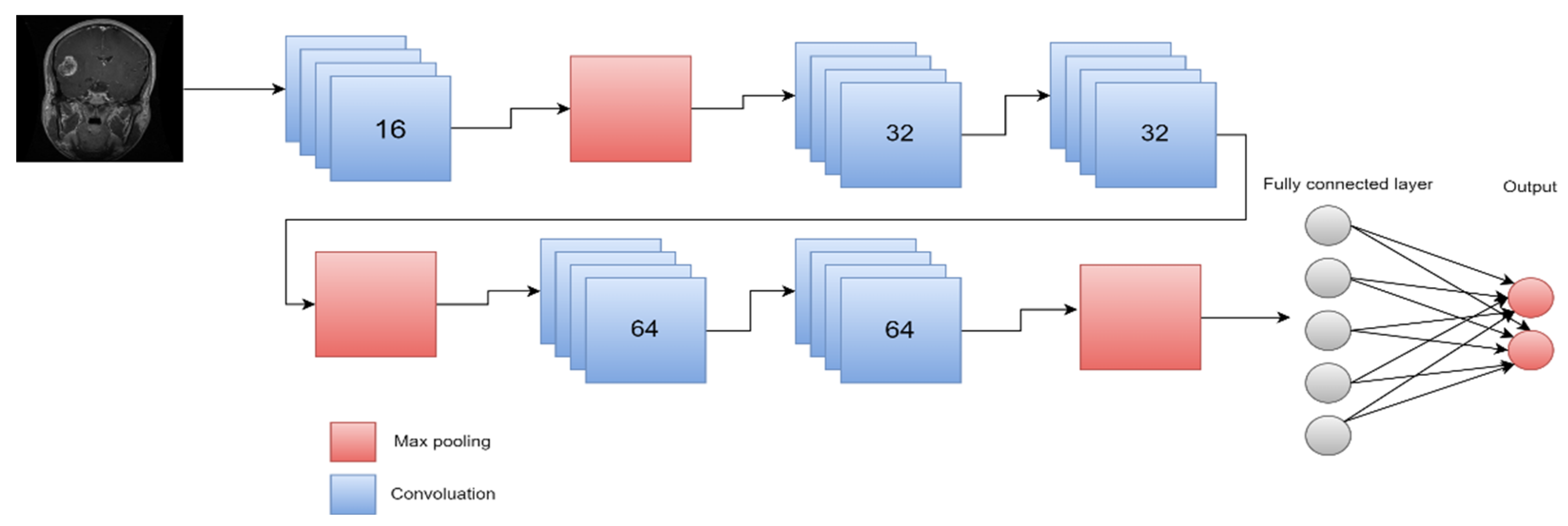 A Review of Recent Advances in Brain Tumor Diagnosis Based on AI-Based Classification