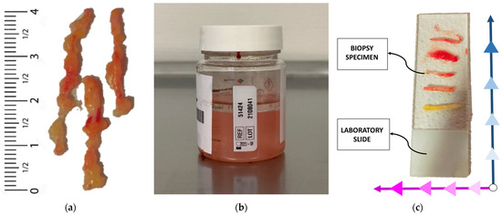 Dielectric Characterization of Breast Biopsied Tissues as Pre ...