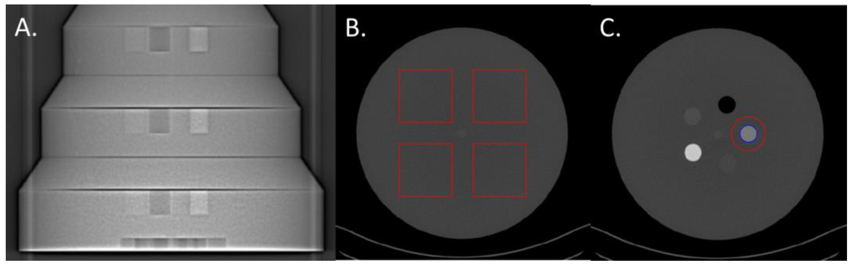 Diagnostics | Free Full-Text | Impact of Phantom Size on Low-Energy Virtual Monoenergetic Images ...