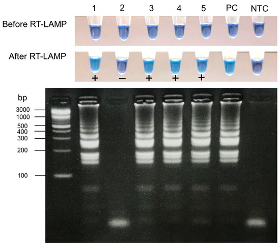 Diagnostics | Free Full-Text | A Single-Tube Colorimetric Loop-Mediated ...