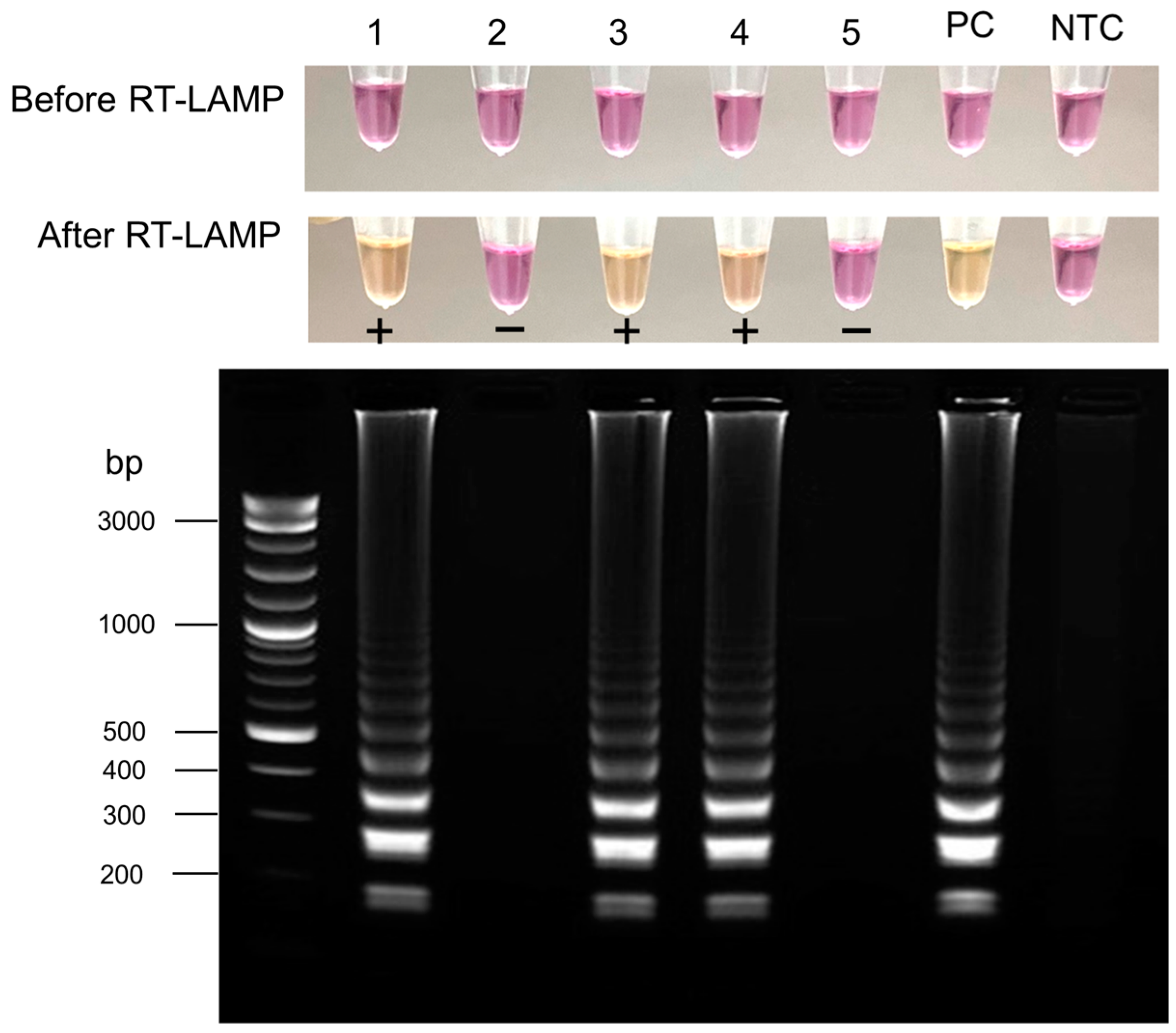 Diagnostics | Free Full-Text | A Single-Tube Colorimetric Loop-Mediated ...