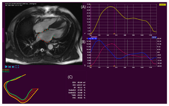 Multimodality Imaging in Patients with Hypertrophic Cardiomyopathy and ...