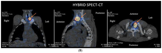 Nuclear Medicine and Cancer Theragnostics: Basic Concepts