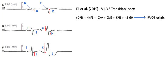 Electrocardiographic Characteristics, Identification, and Management of ...
