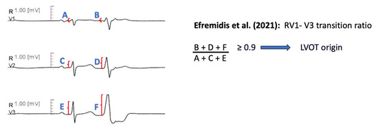 Electrocardiographic Characteristics, Identification, and Management of ...