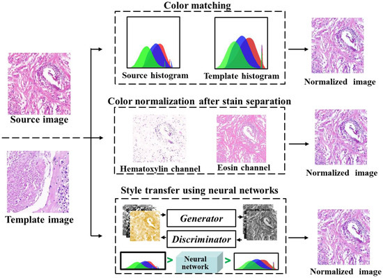 Preparing Data for Artificial Intelligence in Pathology with Clinical ...