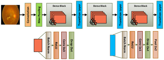 RDS-DR: An Improved Deep Learning Model for Classifying Severity Levels ...