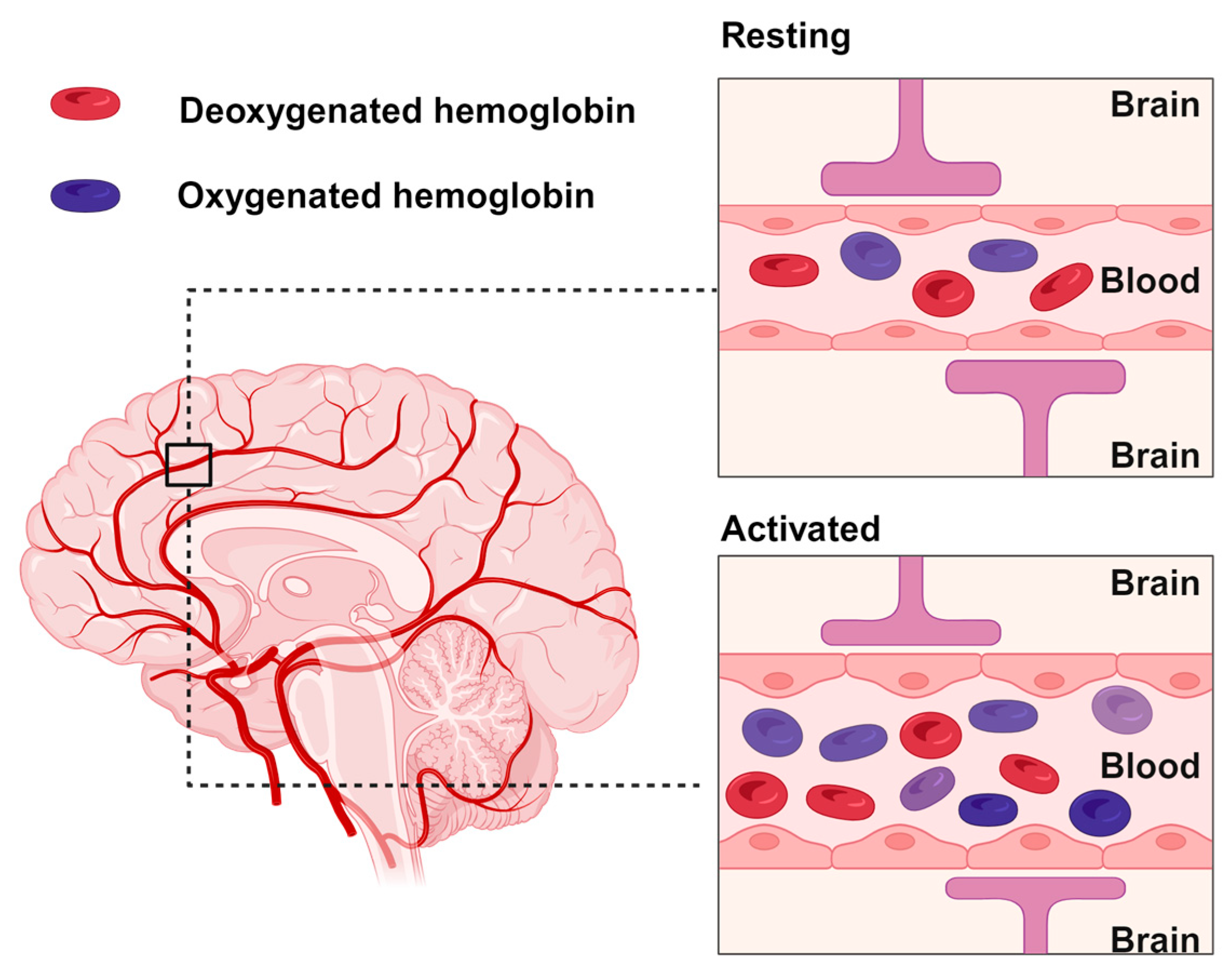 Functional FDG-PET: Measurement of Task Related Neural Activity in ...