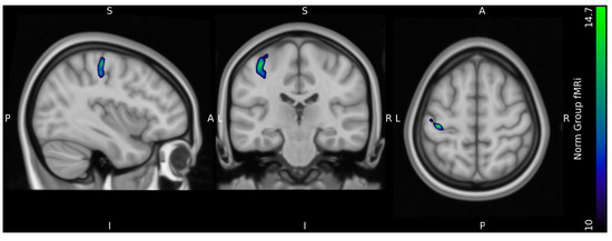 Functional FDG-PET: Measurement of Task Related Neural Activity in ...