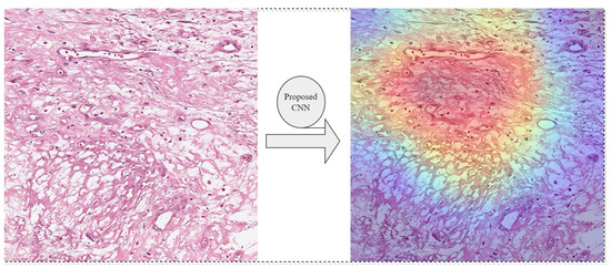 Adapted Deep Ensemble Learning-Based Voting Classifier for Osteosarcoma Cancer Classification