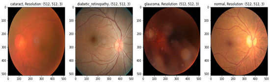 Deep-Ocular: Improved Transfer Learning Architecture Using Self-Attention and Dense Layers for ...