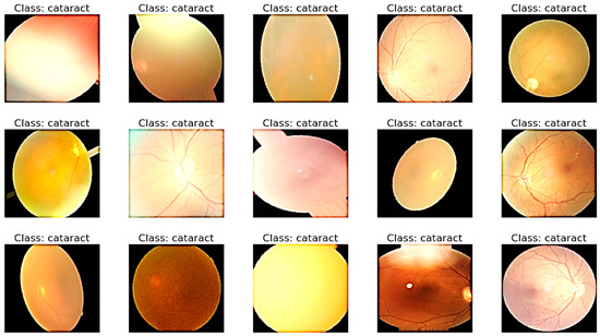 Diagnostics | Free Full-Text | Deep-Ocular: Improved Transfer Learning ... Diagnostics | Free Full-Text | Deep-Ocular: Improved Transfer Learning ...
