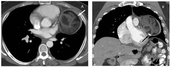Diagnostics | Free Full-Text | Approach to Imaging of Mediastinal Masses
