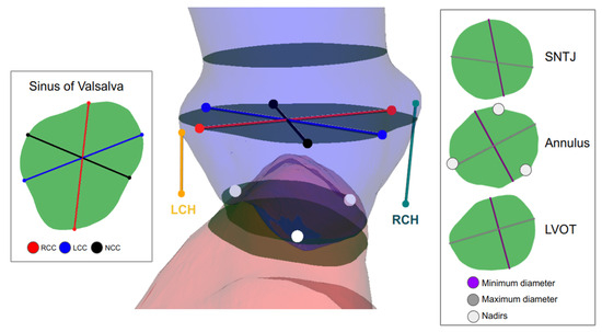 TAVI-PREP: A Deep Learning-Based Tool for Automated Measurements ...