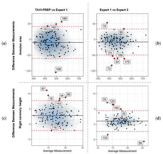 TAVI-PREP: A Deep Learning-Based Tool for Automated Measurements ...