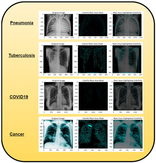 Diagnostics | Free Full-Text | MixNet-LD: An Automated Classification System for Multiple Lung ...
