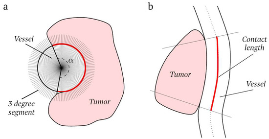 Diagnostics | Free Full-Text | Computed Tomography-Based Radiomics ...