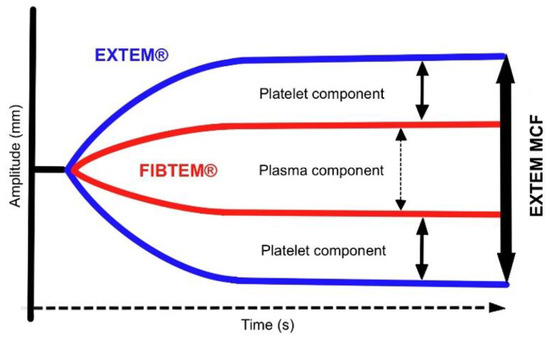 Basic Principles of Rotational Thromboelastometry (ROTEM®) and the Role ...