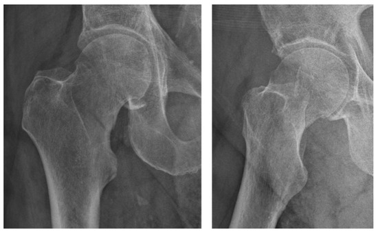 A Case Showing a New Diagnostic Aspect of the Application of ...