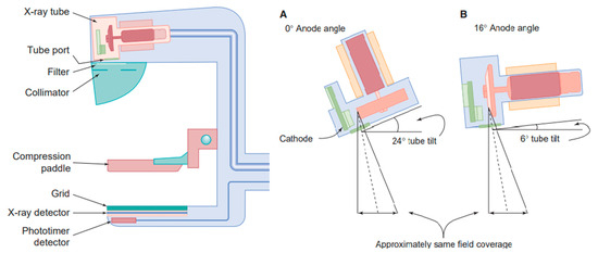 Breast Imaging Physics in Mammography (Part I)