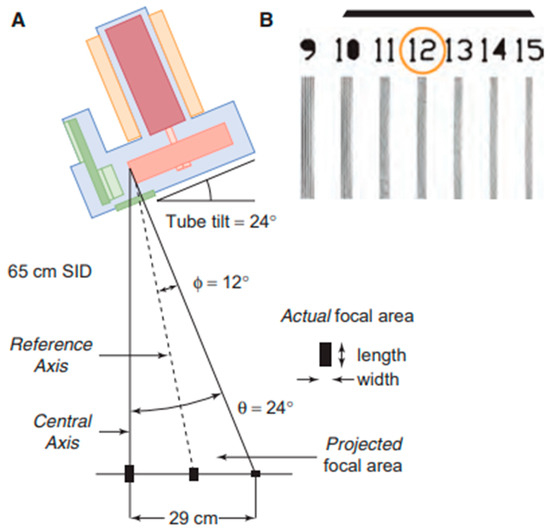 Breast Imaging Physics in Mammography (Part I)