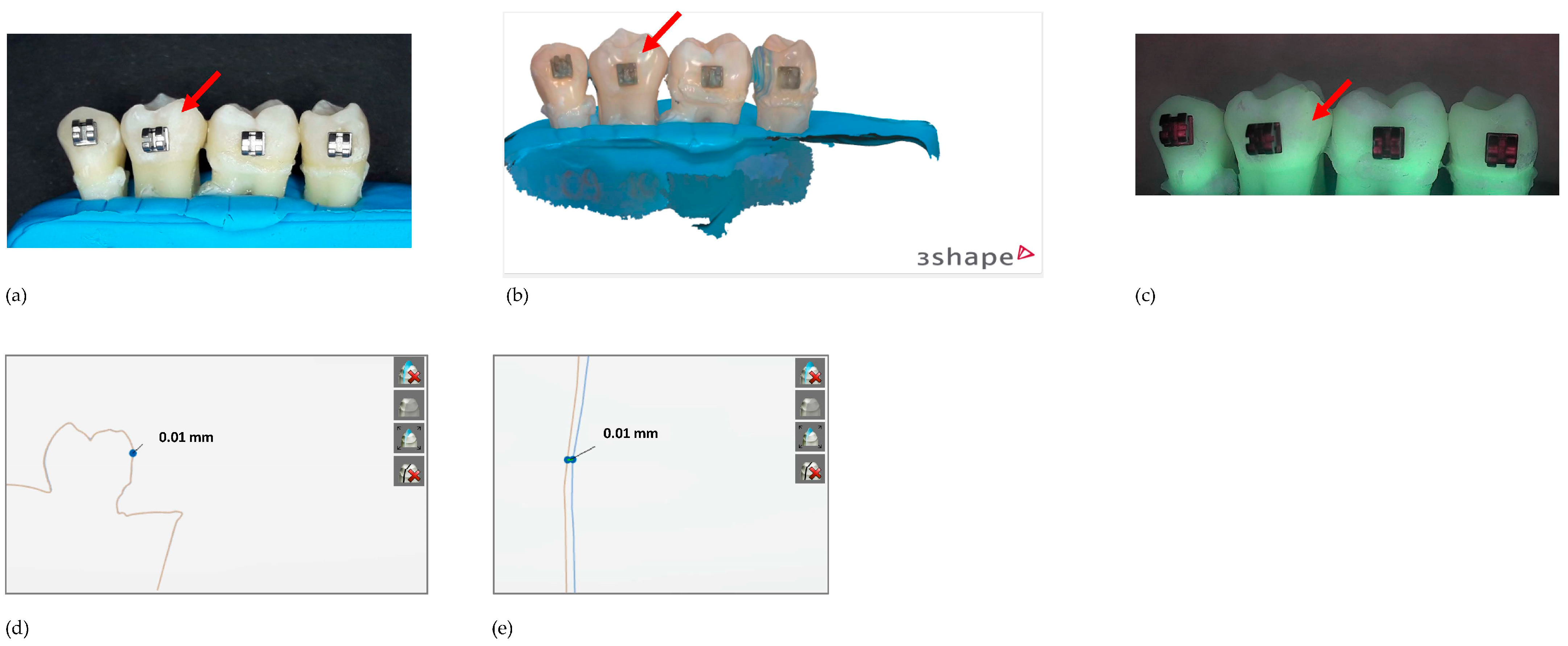 Detection of Erosive Changes on Smooth Surfaces with and without ...