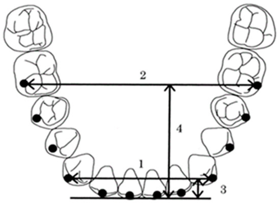 Characteristics of Mandibular Arch Forms in Patients with Skeletal Mandibular Prognathism