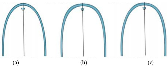 Characteristics of Mandibular Arch Forms in Patients with Skeletal Mandibular Prognathism