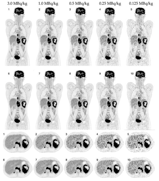 Image Quality and Quantitative PET Parameters of Low-Dose [18F]FDG PET in a Long Axial Field-of ...