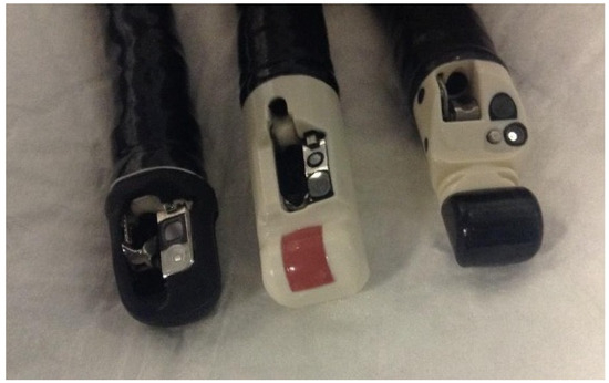 The Endoscopic Retrograde Cholangiopancreatography and Endoscopic ...