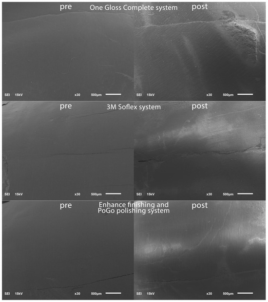 Comparison of Enamel Surface Integrity after De-Bracketing as Affected ...