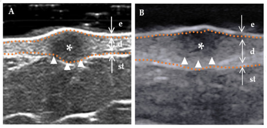 High-Frequency Ultrasound Imaging to Distinguish High-Risk and Low-Risk ...