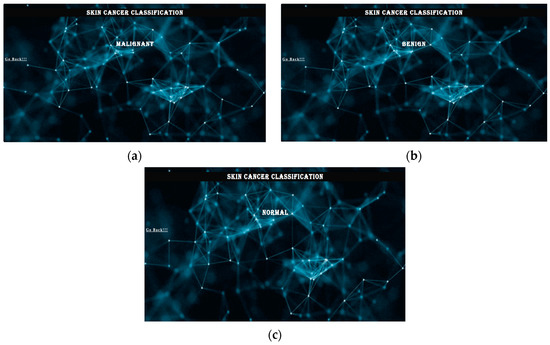 Diagnostics | Free Full-Text | Detection and Classification of Melanoma ...