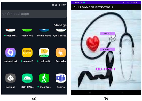 Detection and Classification of Melanoma Skin Cancer Using Image ...
