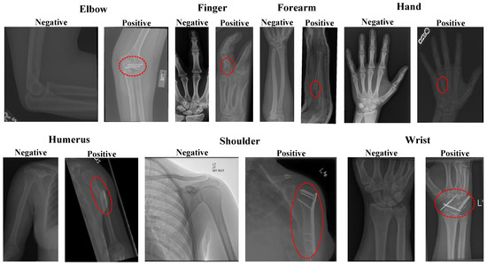 A Pyramid Deep Feature Extraction Model for the Automatic ...