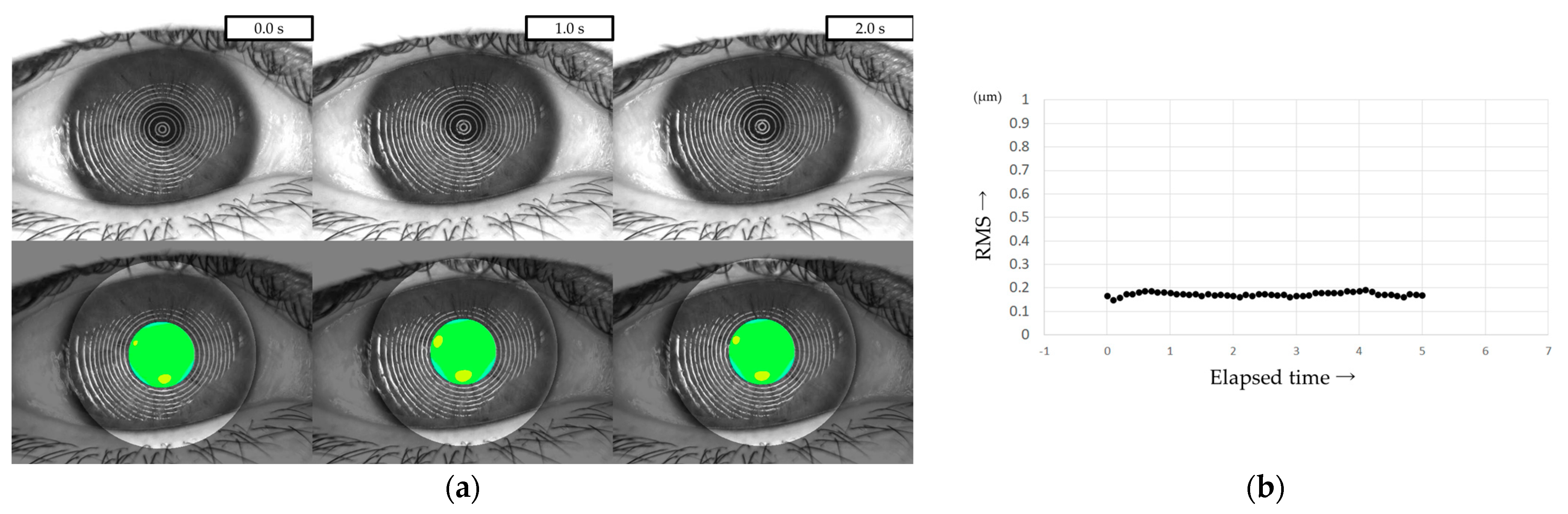 Diagnostics | Free Full-Text | Association between Corneal Higher-Order Aberrations Evaluated ...