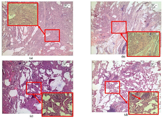 Multimodal Diagnostics of Changes in Rat Lungs after Vaping
