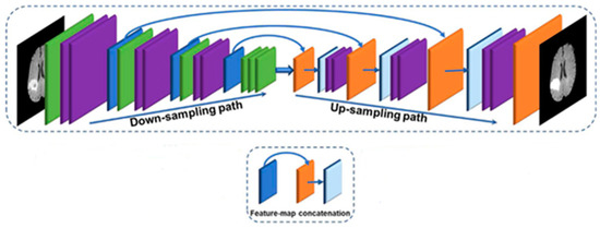 Diagnostics | Free Full-Text | Segmentation of Brain Tumor Using a 3D Generative Adversarial Network